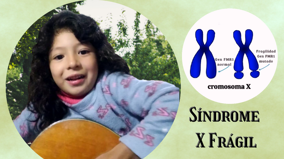 Síndrome X Frágil – Autismo Ciudad de México